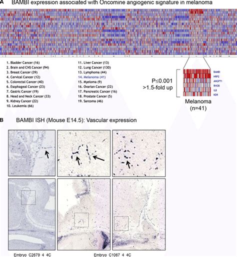 Five Genes Of The Oncomine Angiogenesis Gene Signature Were