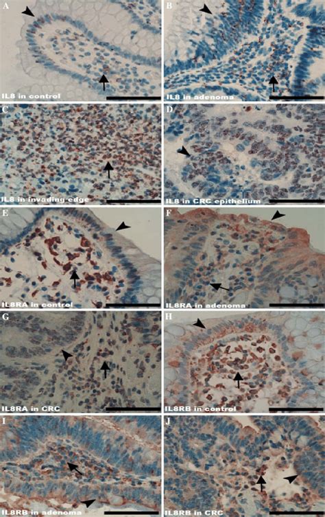 Examinations Of Il 8 And Il 8 Receptor Il 8ra Il 8rb Expression In Download Scientific