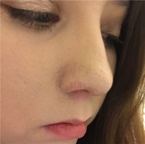 Why Does My Makeup Look Cakey Around My Nose Saubhaya Makeup
