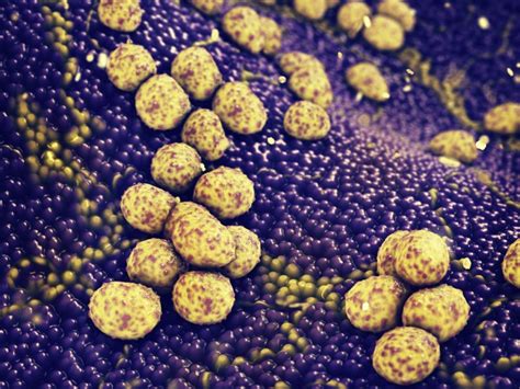 Louisette Bourdin On Linkedin Un Nouvel Antibiotique Imparable Contre