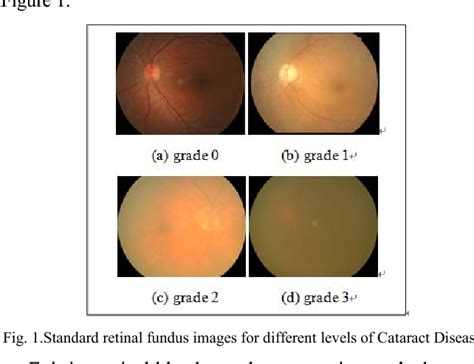 Figure 1 From Vessel Recognition Of Retinal Fundus Images Based On Fully Convolutional Network