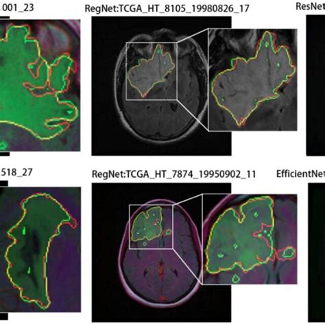 Segmentation Results For Regions With Noise In Parts The Red And Green Download Scientific