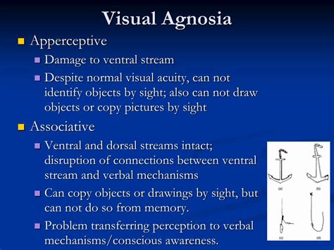 Ppt Vision Powerpoint Presentation Free Download Id1177264