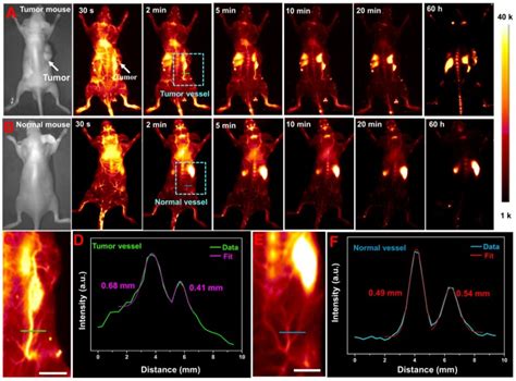 Polydopamine Coated Multifunctional Lanthanide Theranostic Agent For Vascular Malformation And