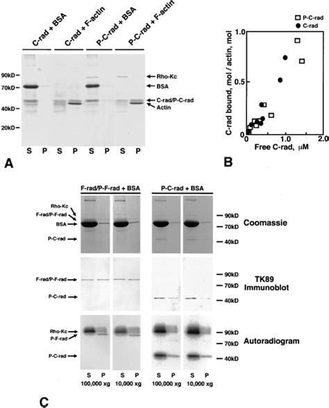 Effects Of T564 Phosphorylation In Radixin On The Actin Filament