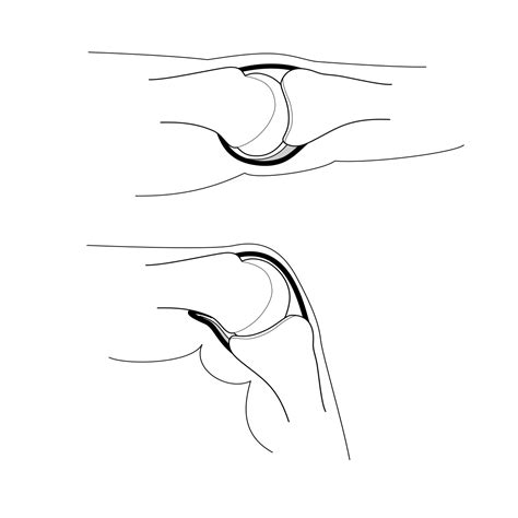 File Metacarpophalangeal Joint Illustration Svg Wikimedia Commons