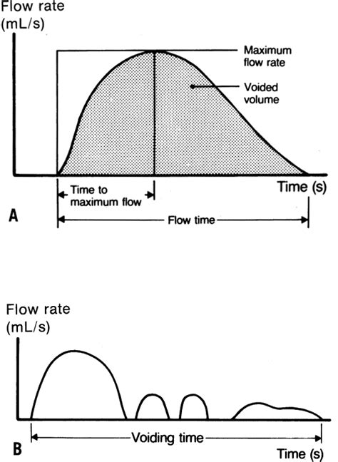 Normal Uroflow Chart Keski