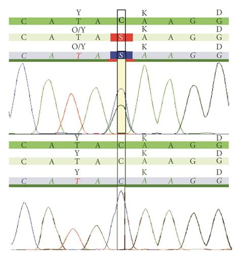 Electropherogram Of Molecular Analysis In The Patient Sample The Upper Download Scientific