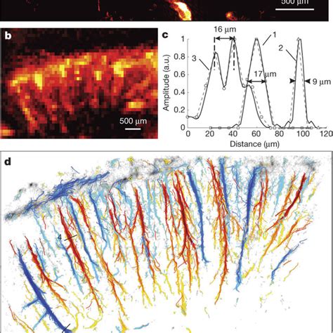 Pdf Ultrafast Ultrasound Localization Microscopy For Deep Super Resolution Vascular Imaging