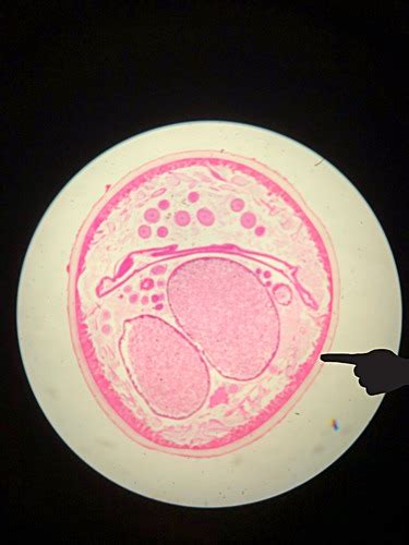 Nematode Dissectioncross Section Flashcards Quizlet