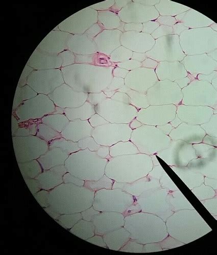 Biol 223 Lab Quiz 3 Flashcards Quizlet
