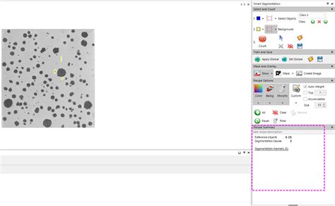 Smart Segmentation Issue Media Cybernetics Image Analysis Forums