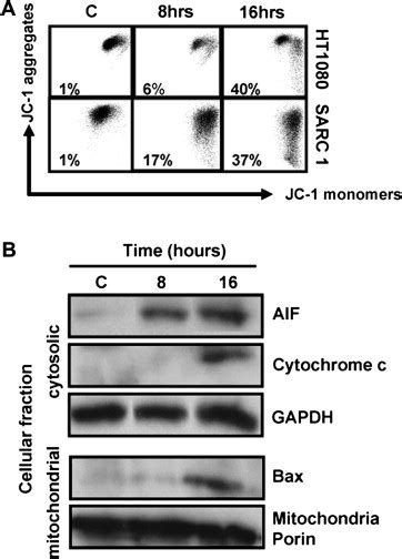 Antitumor Activity Of Polyuridylic Acid In Human Soft Tissue And Bone Sarcomas Journal Of