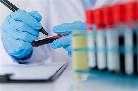 What Does A Non Reactive Hiv Test Result Mean