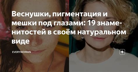 Веснушки пигментация и мешки под глазами 19 знаменитостей в своём натуральном виде