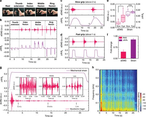 Robust Recognition Of Finger Flexions And The Speed And Fatigue Of Hand Download Scientific