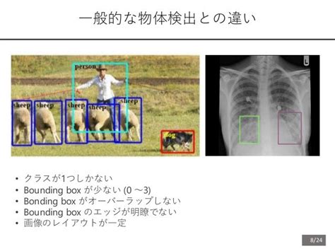 Kaggle Rsna Pneumonia Detection Challenge 解法紹介