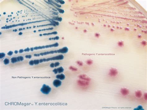 Chromagar Yersinia Enterocolitica Scharlab