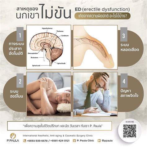 P Paula Clinic นกเขาไม่ขัน มีสาเหตุ 🧐 ความเครียดสะสม