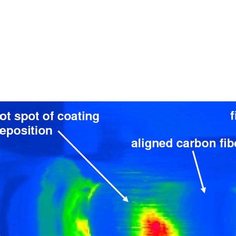 Thermographic Ir Image Of The Surface Temperature Distribution During
