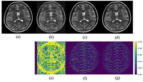 What Is Ai Deep Learning Based Mri Reconstruction Ai Art Central