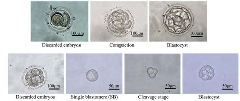 Representative Examples Of Blastocyst Formation A Representative Download Scientific Diagram