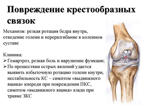 Травмы коленного сустава у спортсменов Оперативное лечение повреждений презентация онлайн