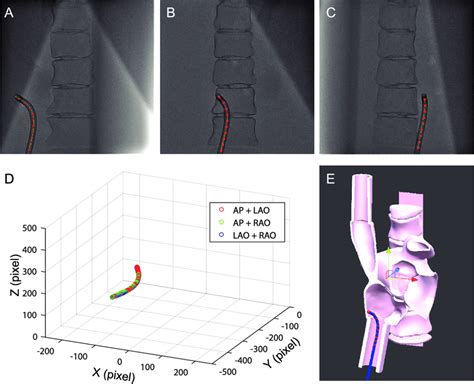 Localization Of Catheter In 3d Space A Bandc The Catheter Is Detected Download Scientific