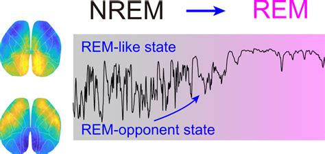 Diagram Illustrating Cortical Activity During Nrem To Rem Download