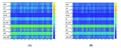 Connectivity Profiles For All The Connectivity Metrics For Eyes Closed Download Scientific