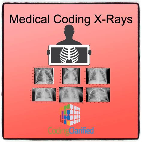 Medical Coding X Ray Coding Clarified
