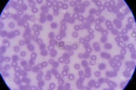 血液涂片 红细胞