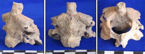 Tell Tweini Burial Twe A 00177 Congenitally Fused Cervical Vertebrae Download Scientific