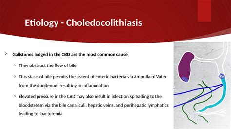 Acute Cholangitis Diagnostic Criteria And Managementpptx