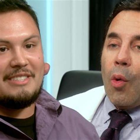 4 Botched Patients Shock Doctors Paul Nassif And Terry Dubrow