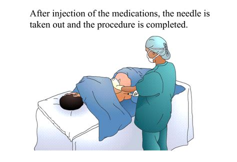 Trigger Point Injections