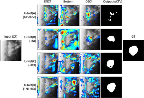 Figure4 Impact Of Data Augmentations On Attention Heatmaps And
