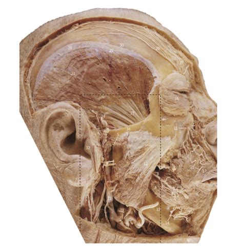 Right Temporal Fossa Diagram Quizlet