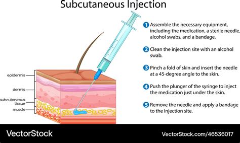 Subcutaneous Injection With Explanation Royalty Free Vector