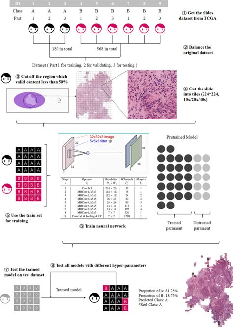 High Accuracy Oral Squamous Cell Carcinoma Auxiliary Diagnosis System Based On Efficientnet Pmc