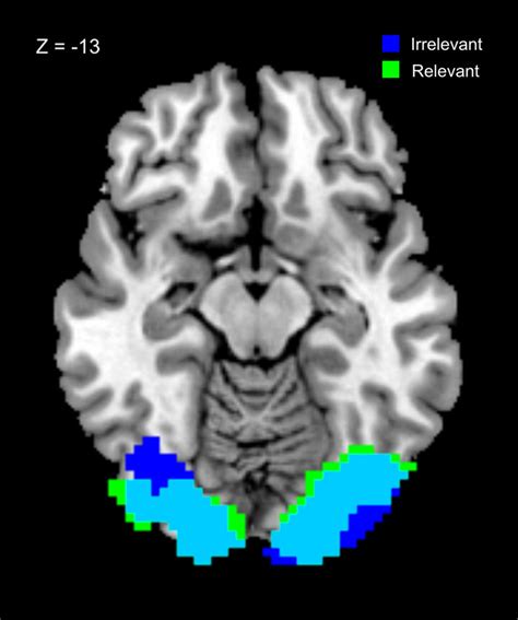 Results Of The Searchlight Decoding Analysis For Visual Stimuli In