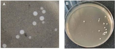 Figure 1 From Symptomatic Cryptococcal Meningitis With Negative Serum And Cerebrospinal Fluid