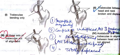 Garden Classification Imp Note Grade 2 All Aligned Grade 3