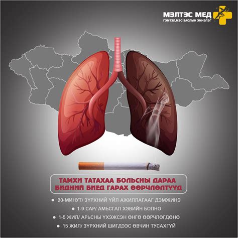 🚭 Тамхи гэж юу вэ Meltes Med Orthoplastic Hospital