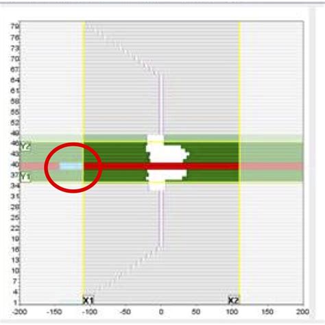 A Snapshot Of An Imrt Step‐and‐shoot Delivery That Captures Number 40 Download Scientific