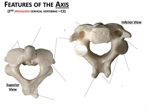 Axis Labeling Diagram Quizlet