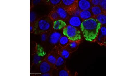 Scientists Discover Several Protein Coding Genes That Were Misidentified