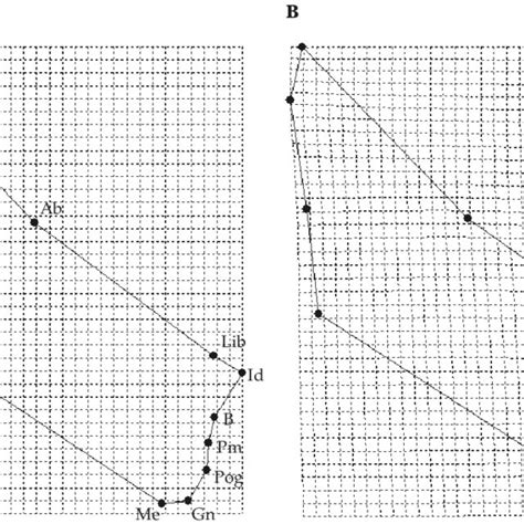 Thin Plate Spline Tps Depiction Of The Mandibular Configuration In A Download Scientific