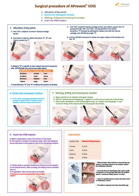 Thyroplasty Implant Dp Medical