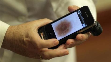 利用卷积神经网络CNN检测皮肤癌准确率高达 卷积神经网络入侵检测